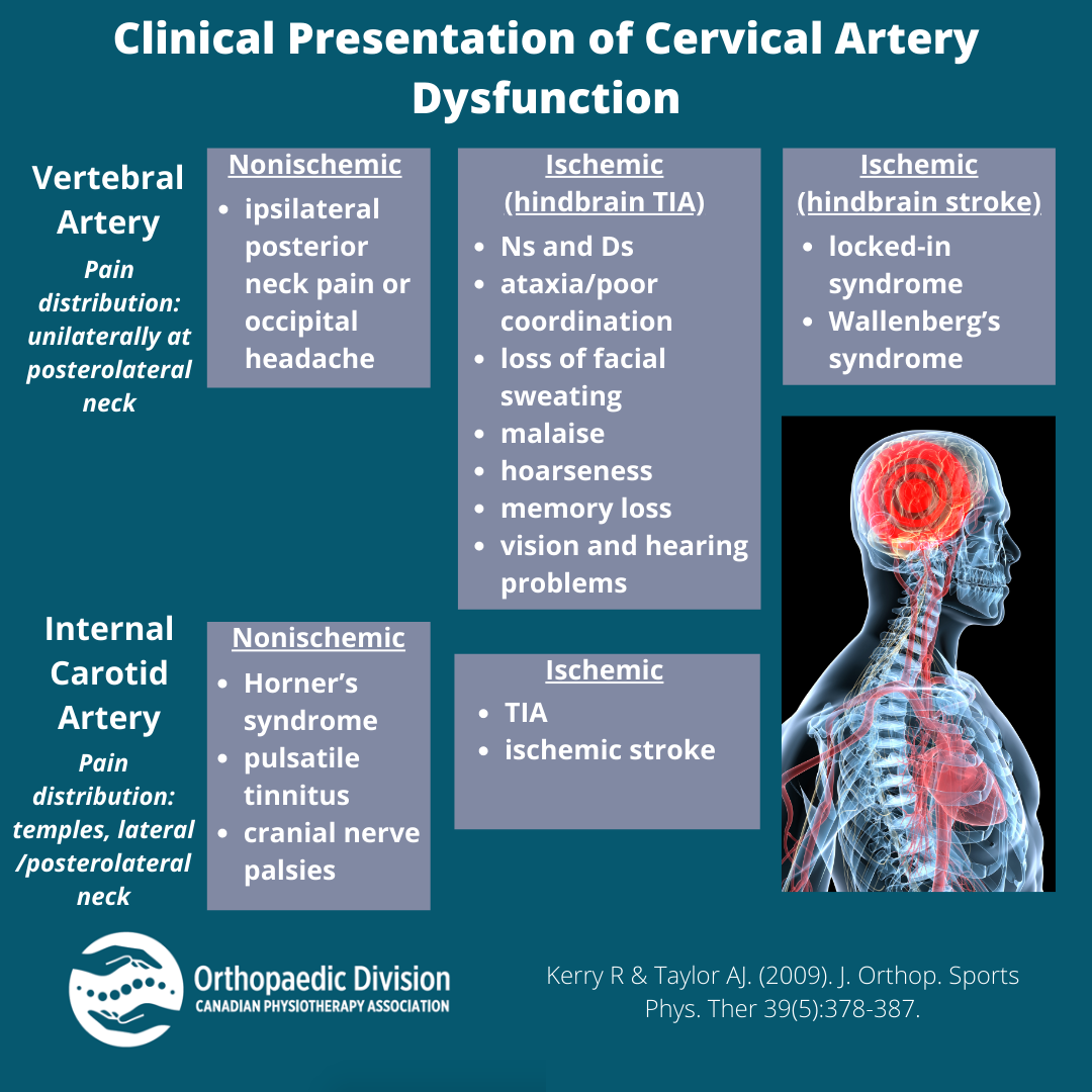 Clinical Presentation Of Cervical Artery Dysfunction National Clinical Presentation Of Cervical Artery Dysfunction National